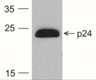 HIV-1 Gag p24 Antibody (7F4) [HRP] (NBP2-41341): Novus Biologicals
